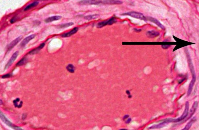Solved in the indicated layer of the blood vessel, smooth | Chegg.com
