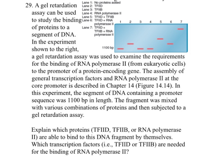 Solved Lane 1: No proteins added 29. A gel retardation Lane | Chegg.com