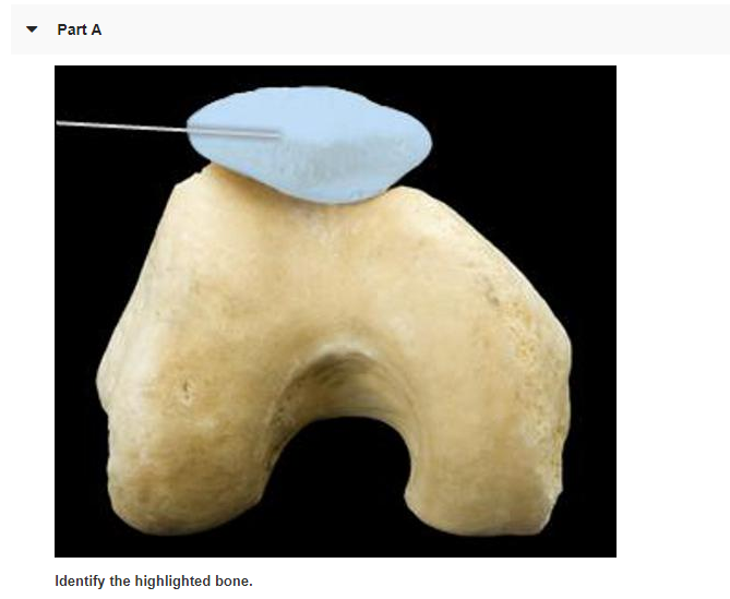 Solved Part A Identify the highlighted bone | Chegg.com