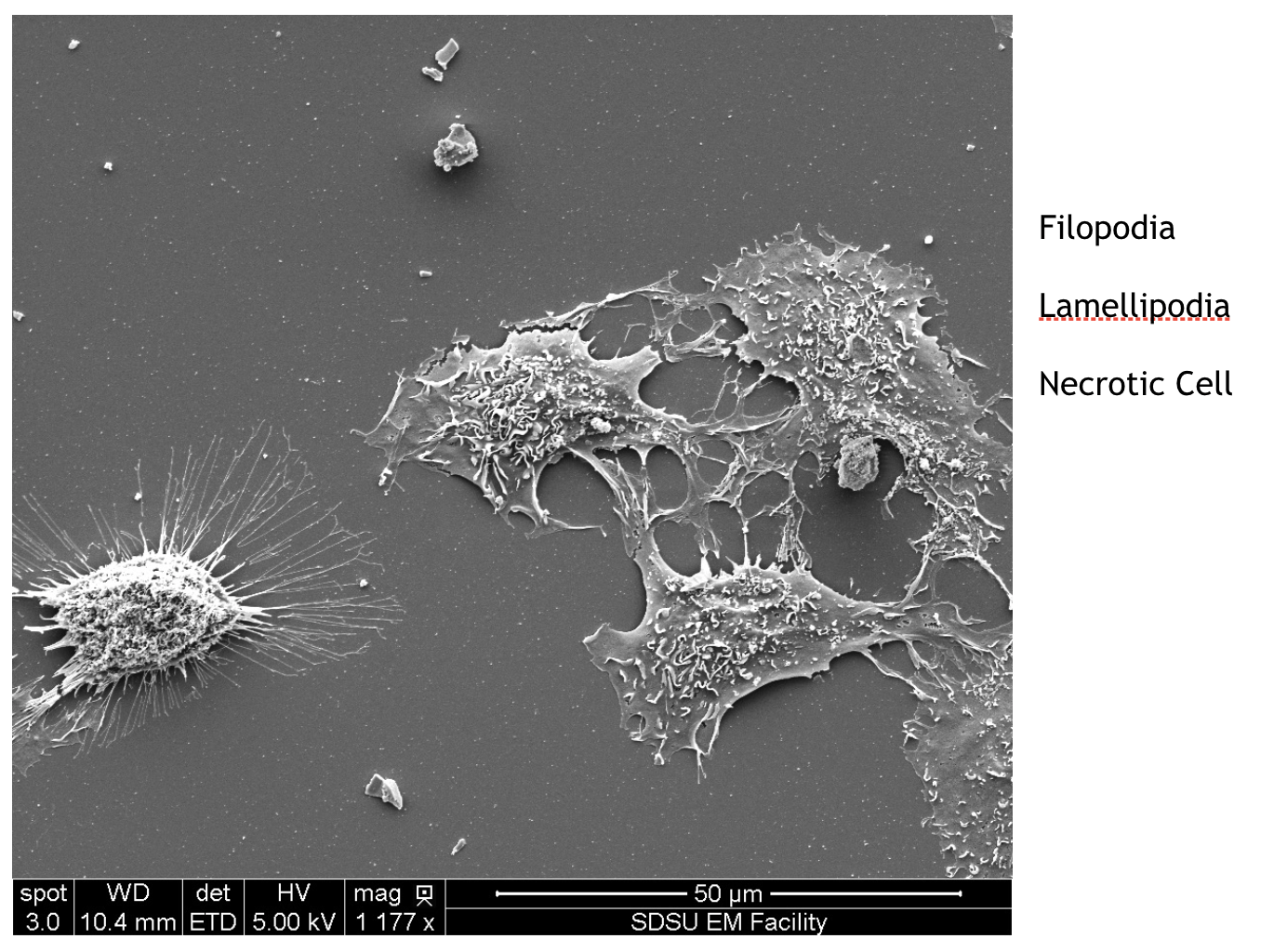 Solved Identify structures in the EM micrographs Match the | Chegg.com