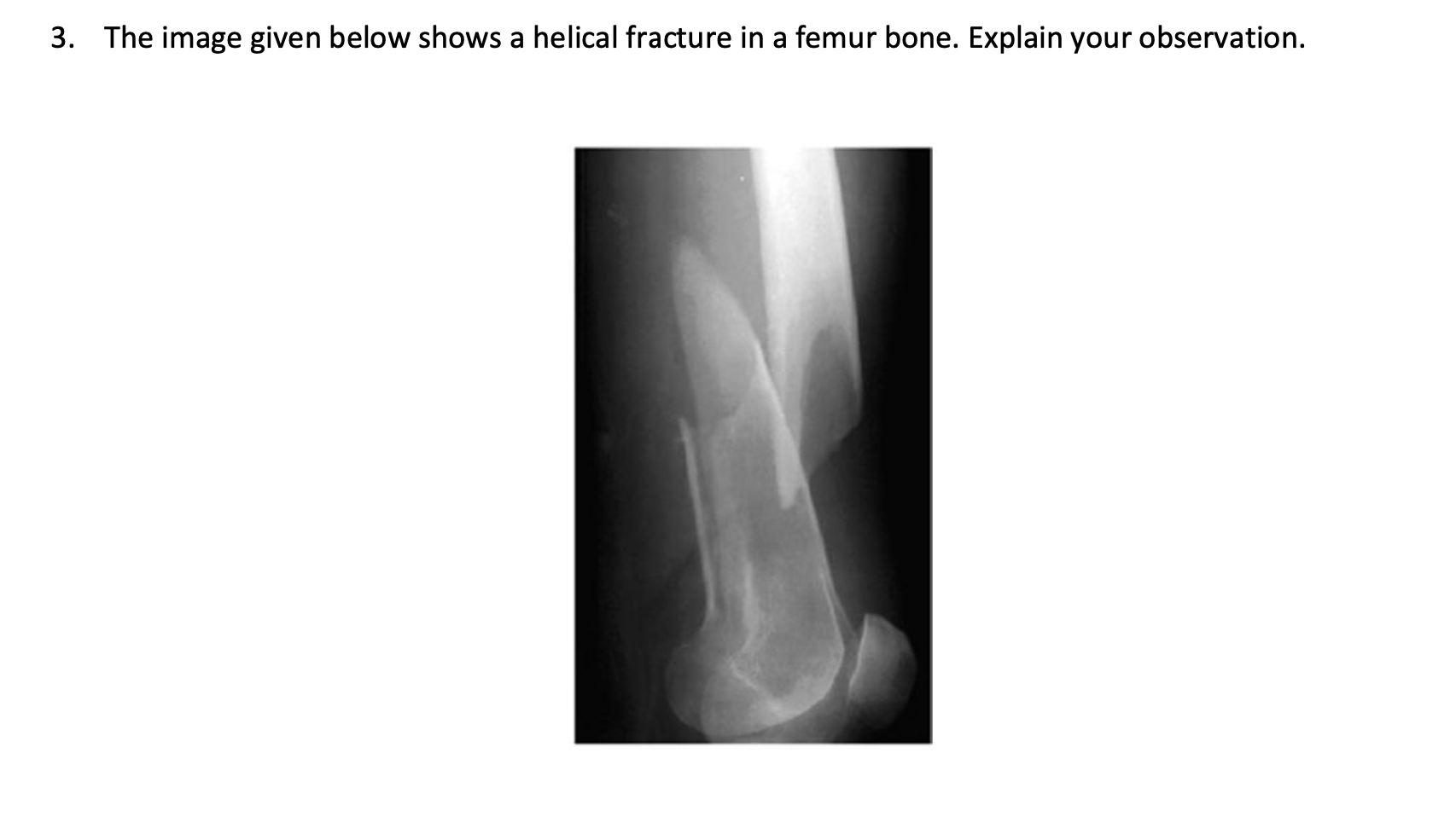 Solved 3. The image given below shows a helical fracture in | Chegg.com