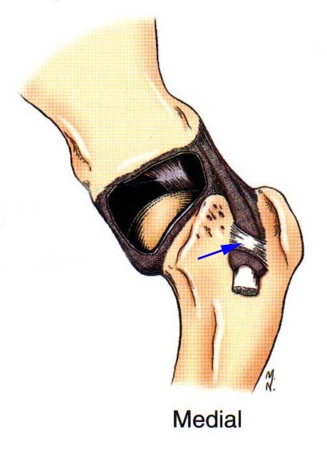 Solved The structure indicated by the blue arrow in the | Chegg.com