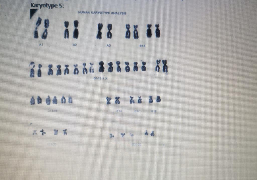 Solved Paragraph Question 6 - Human Karyotype Analysis (10 | Chegg.com