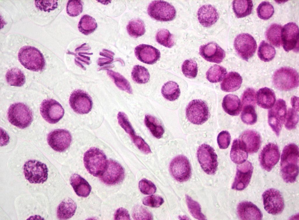 Solved There are five pictures of bean roots. How many cells | Chegg.com