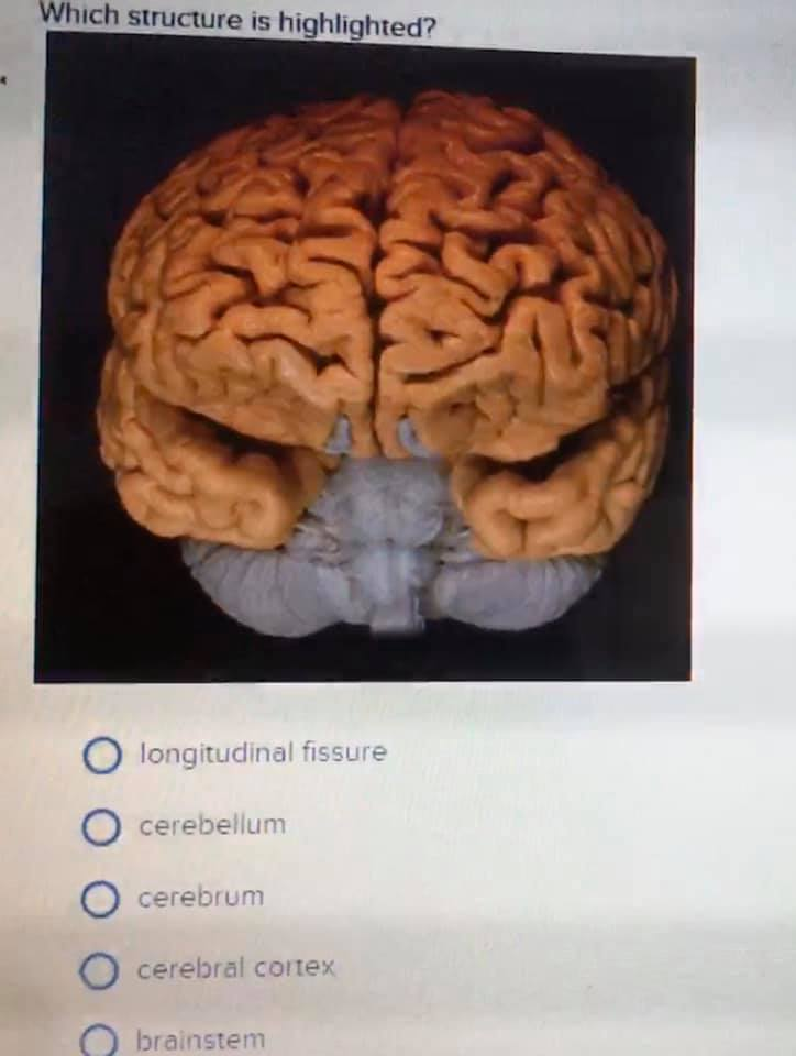 Solved Which structure is highlighted? thalamus medulla | Chegg.com