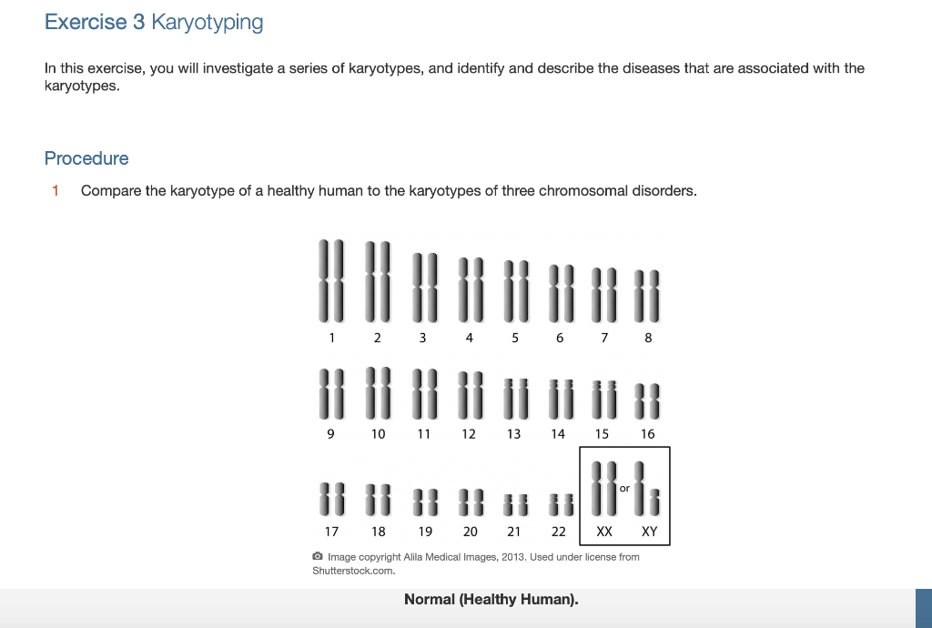 Solved Exercise 3 Karyotyping In this exercise, you will | Chegg.com