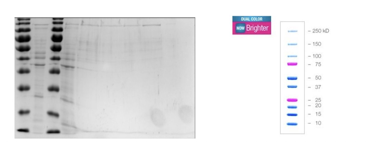 Solved Lane #1 is DNA Ladder, Lane #2 is Crude Lysate, Lane | Chegg.com