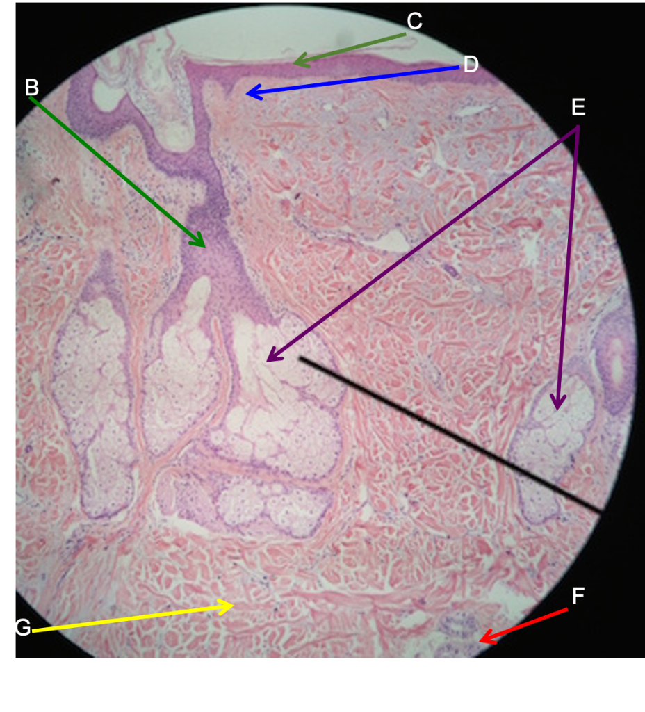 Solved a) Looking at the entire photomicrograph, what is the | Chegg.com