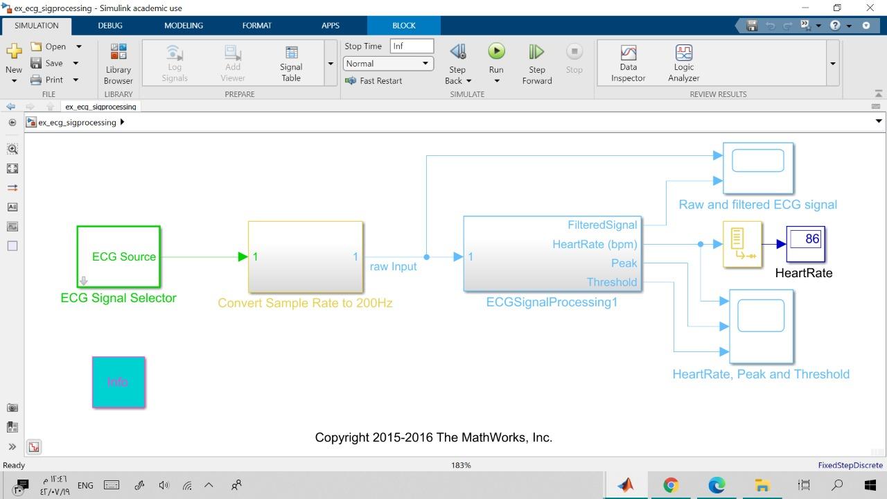 X ex_ecg_sigprocessing/ECGSignal Processing 1 - | Chegg.com