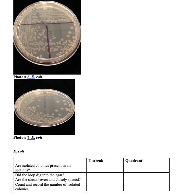 Staphylococcus Epidermidis Streak Plate