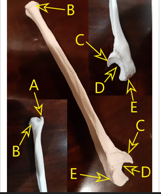 Solved The structure indicated by "A" issuperior angleThe | Chegg.com