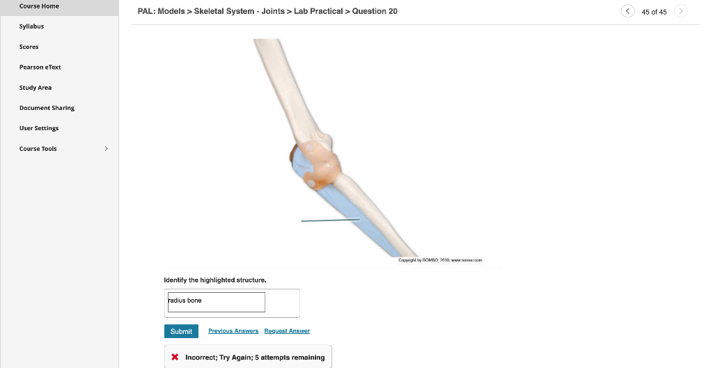 Solved PAL Models Skeletal System Joints Lab Chegg
