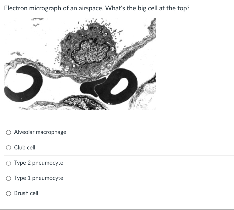 Solved Electron micrograph of an airspace. What's the big | Chegg.com