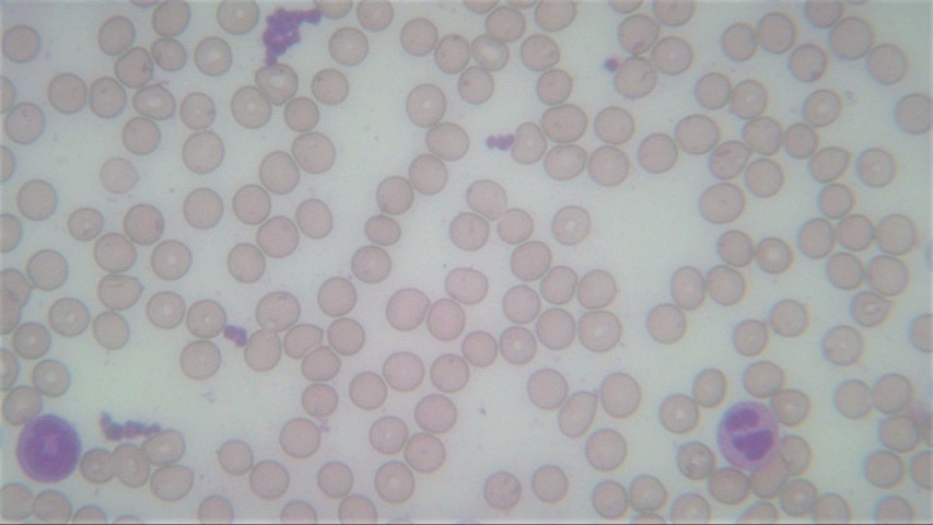 Solved Label at least one leukocyte, erythrocyte, and | Chegg.com