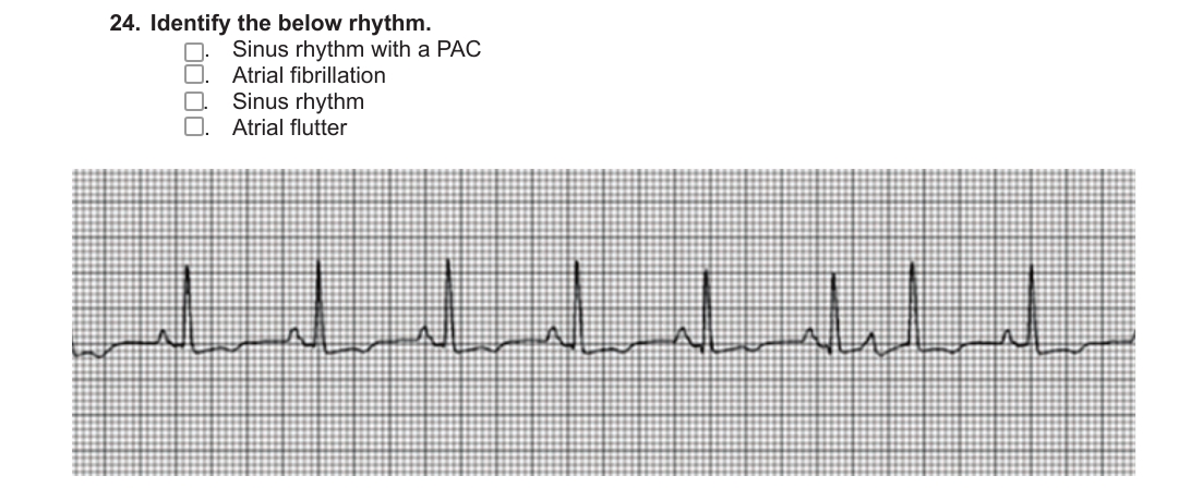 Solved Identify the below rhythm.Sinus rhythm with a | Chegg.com