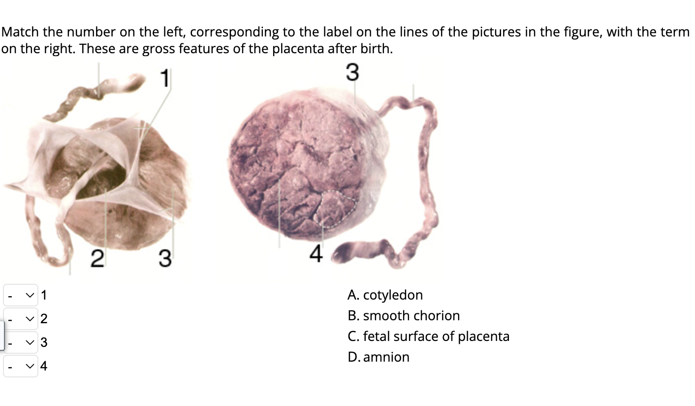 Match the number on the left, corresponding to the | Chegg.com