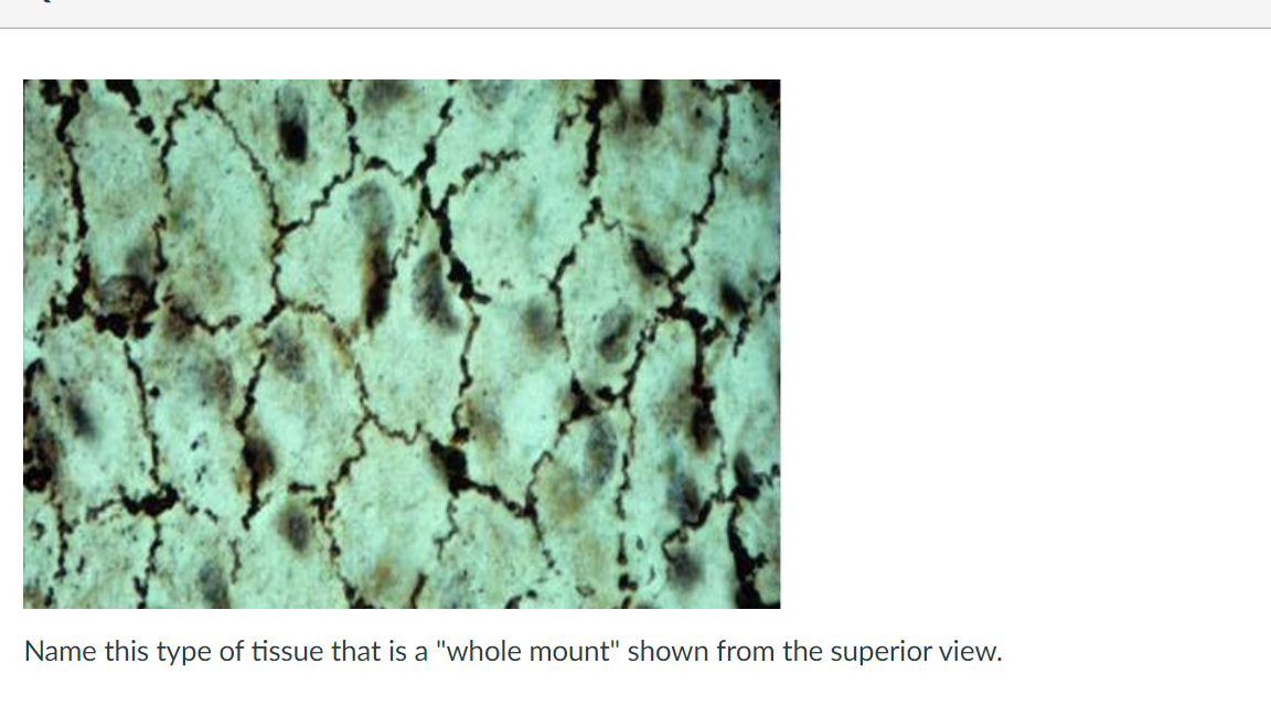 Solved Name this type of tissue that is a "whole mount" | Chegg.com