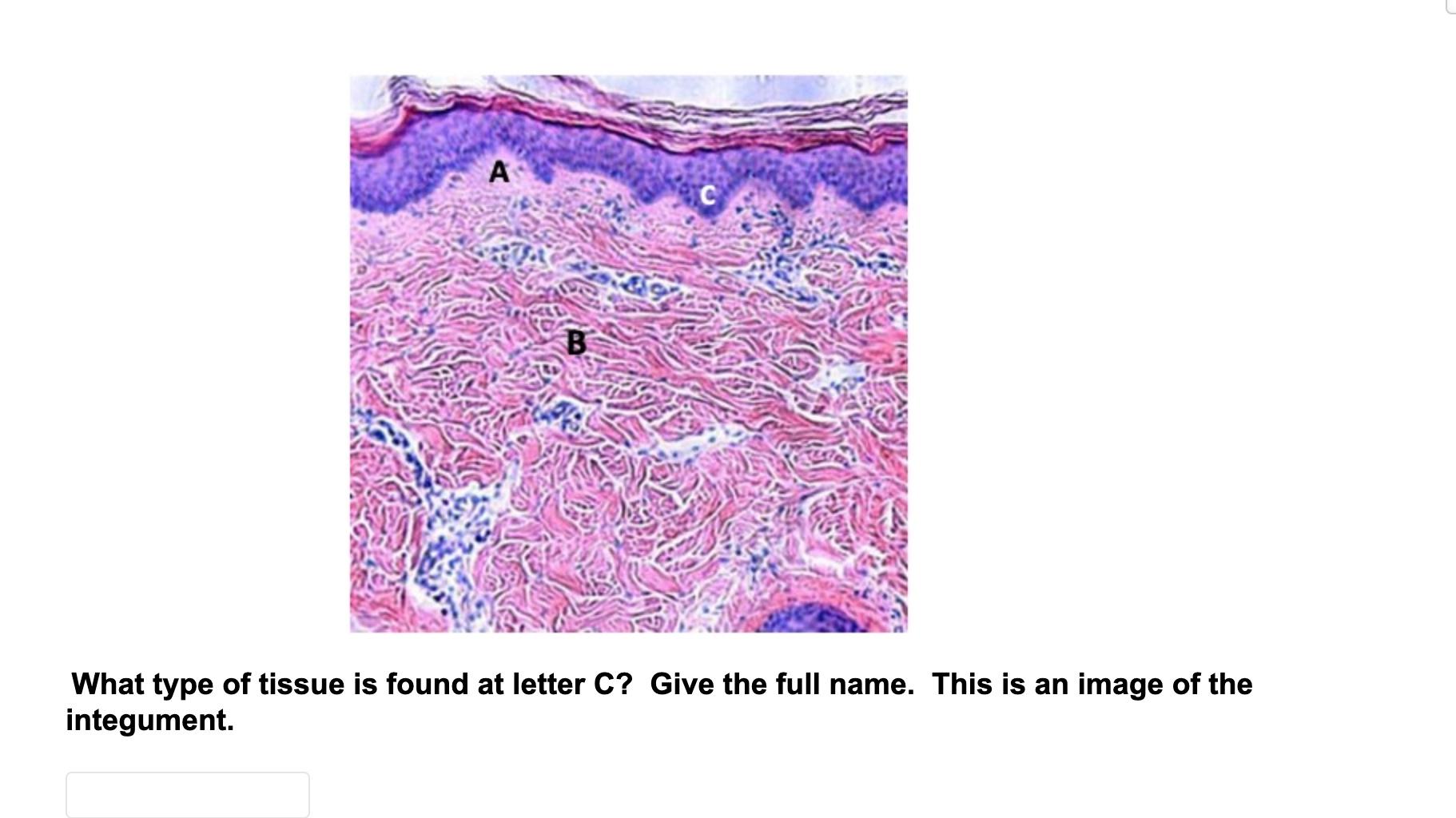 Solved what layer of the skin is letter b? What type of | Chegg.com