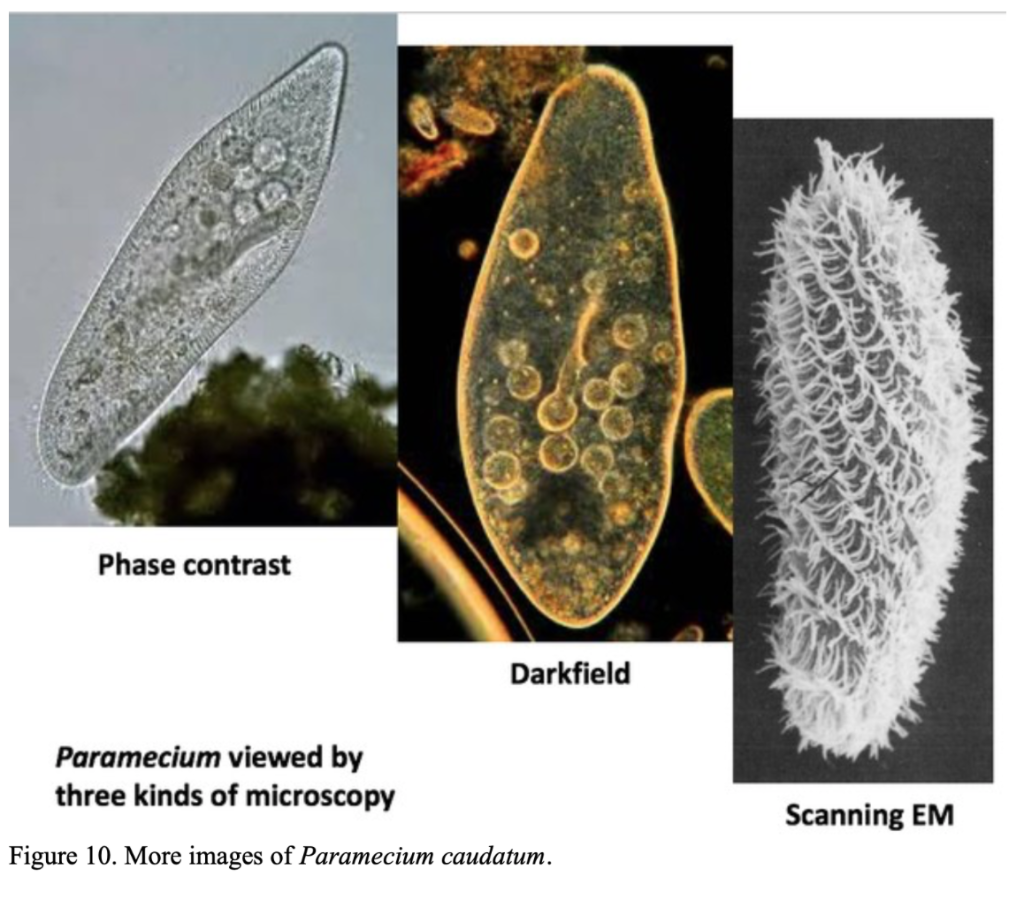 Paramecium Caudatum Under A Microscope 400x