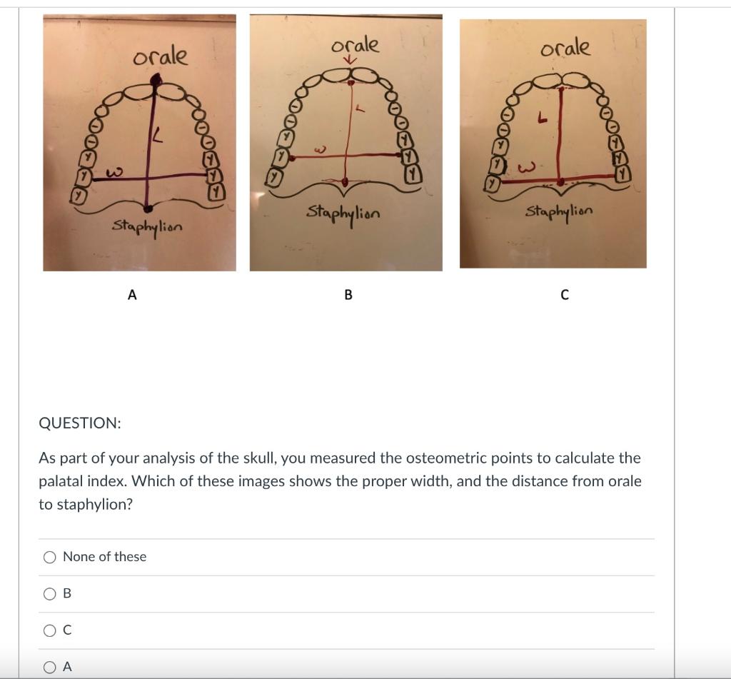 As part of your analysis of the skull, you measured | Chegg.com