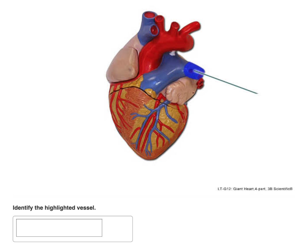 Solved LT-G12: Giant Heart, 4-part, 3B Scientific Identify | Chegg.com