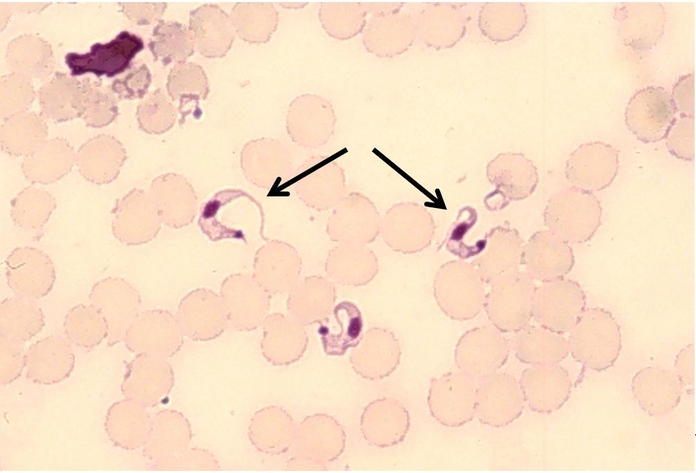 Solved Image #1 Wright stained smear of peripheral | Chegg.com