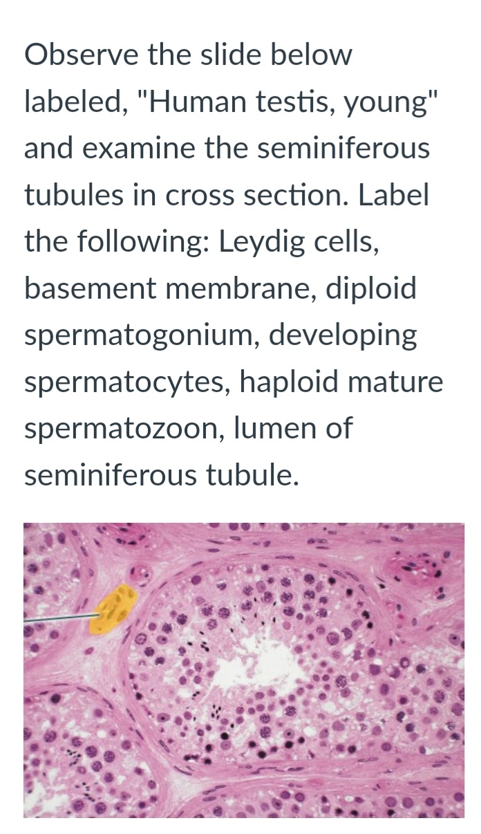 Solved Observe the slide below labeled, "Human testis, | Chegg.com