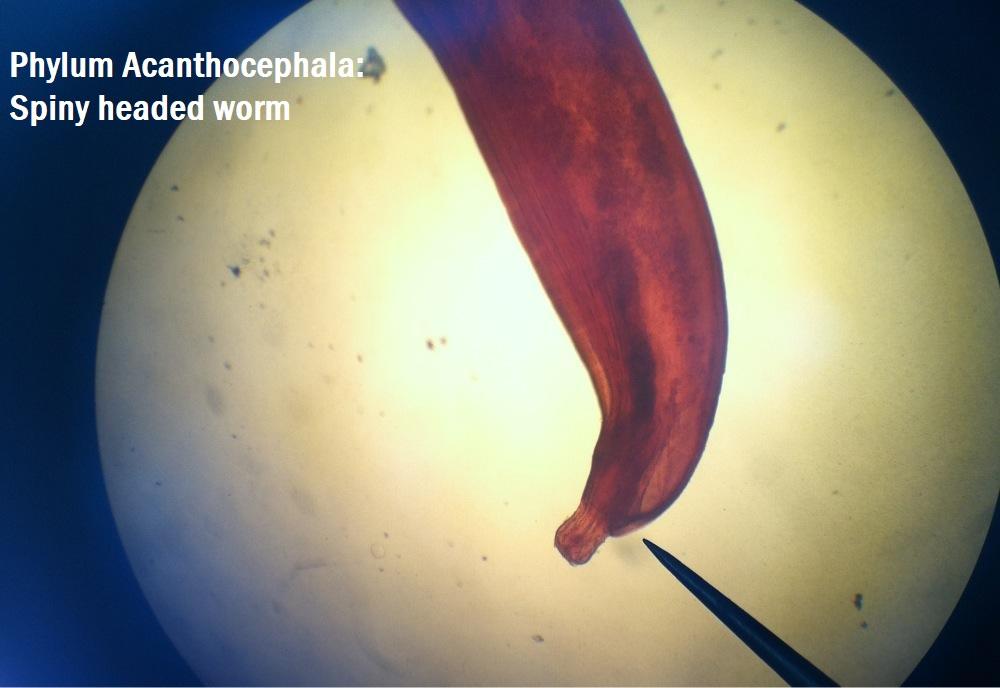 Solved Phylum Acanthocephala: Spiny headed worm | Chegg.com