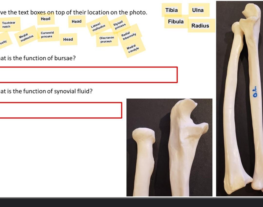Styloid Process Of Fibula
