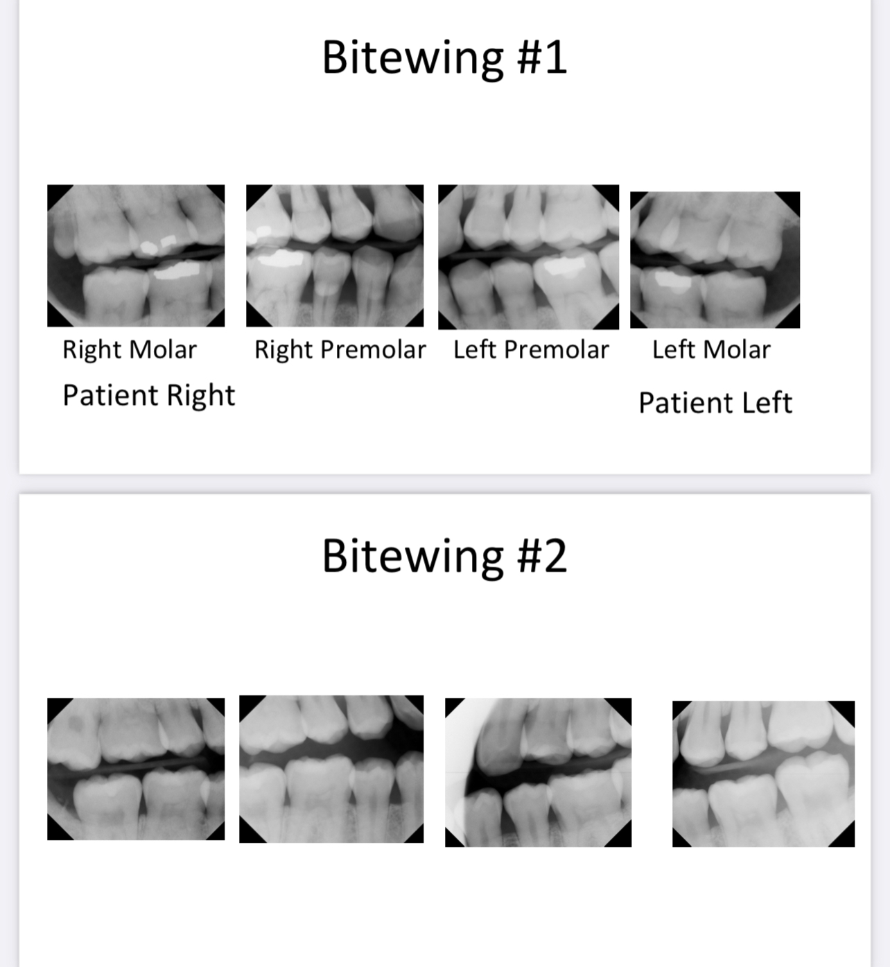 Solved How do you correct the overlapping in these x-ray and | Chegg.com