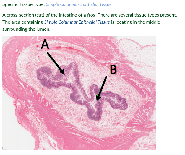 Solved Specific Tissue Type: Simple Columnar Epithelial | Chegg.com