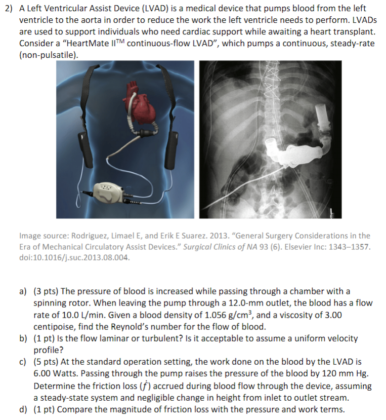Solved A Left Ventricular Assist Device (LVAD) is a medical | Chegg.com