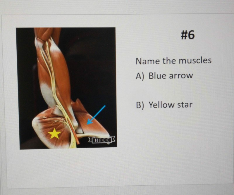 Solved #9 A) What is the name of muscle? (blue arrow) B) | Chegg.com