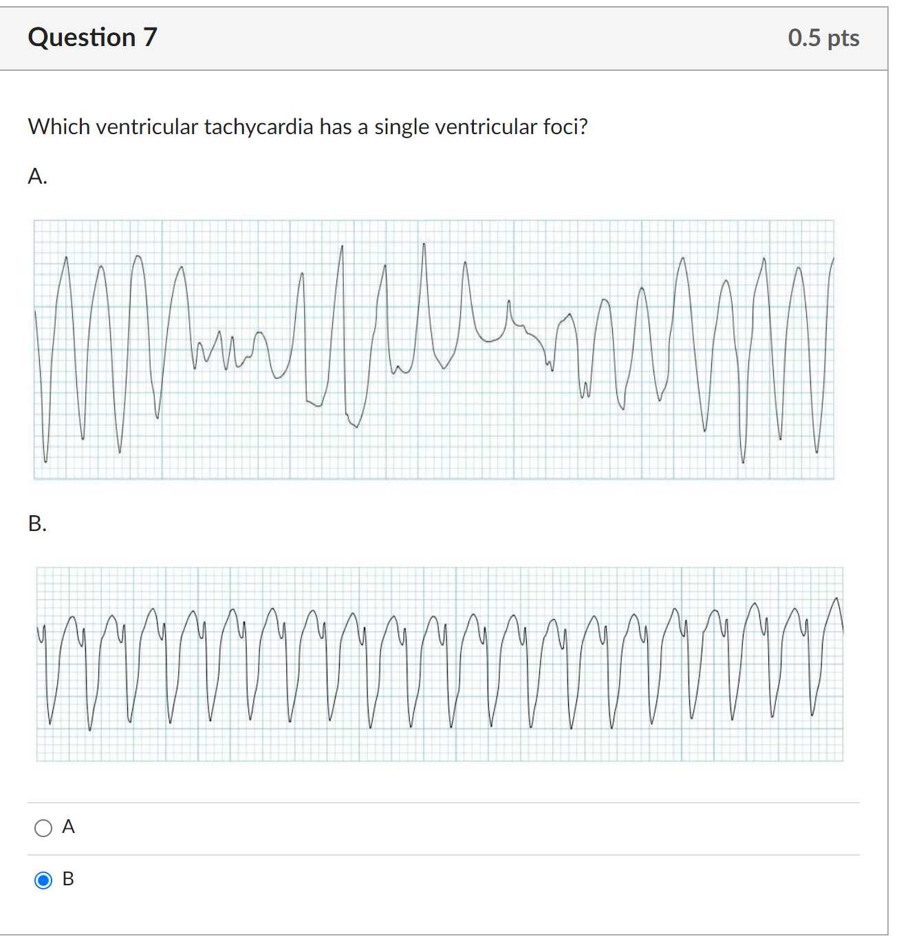 Solved Which ventricular tachycardia has a single | Chegg.com