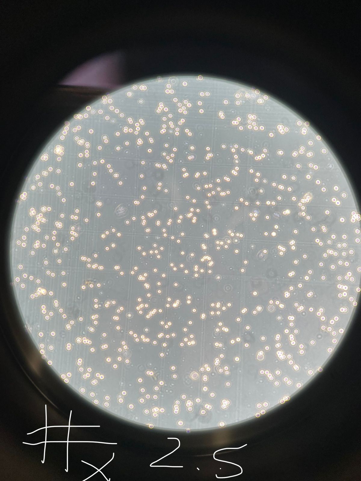 Solved Counting trypsinized cells (with 2.5% 0% (control) | Chegg.com