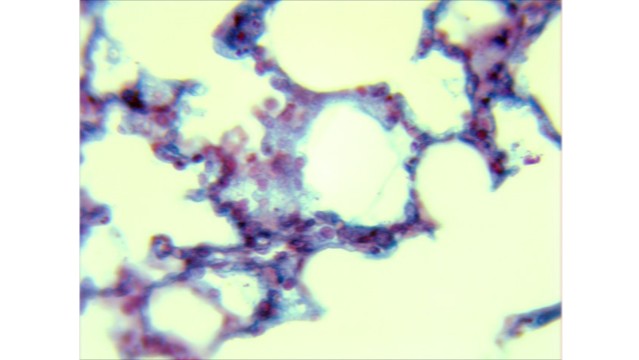Solved From the Lung (simple squamous): Recognize slide at | Chegg.com