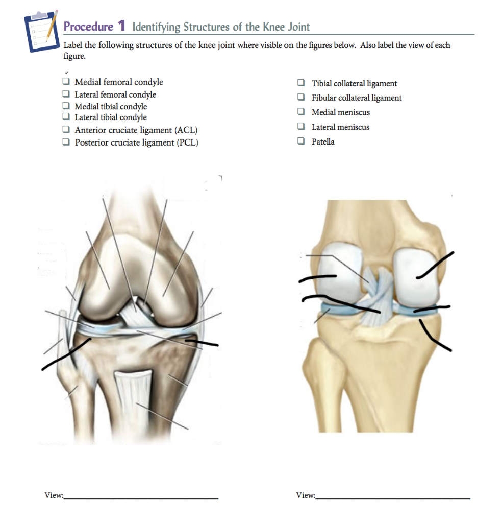 Solved Procedure 1 Identifying Structures of the Knee Joint | Chegg.com Solved Procedure 1 Identifying Structures of the Knee Joint | Chegg.com