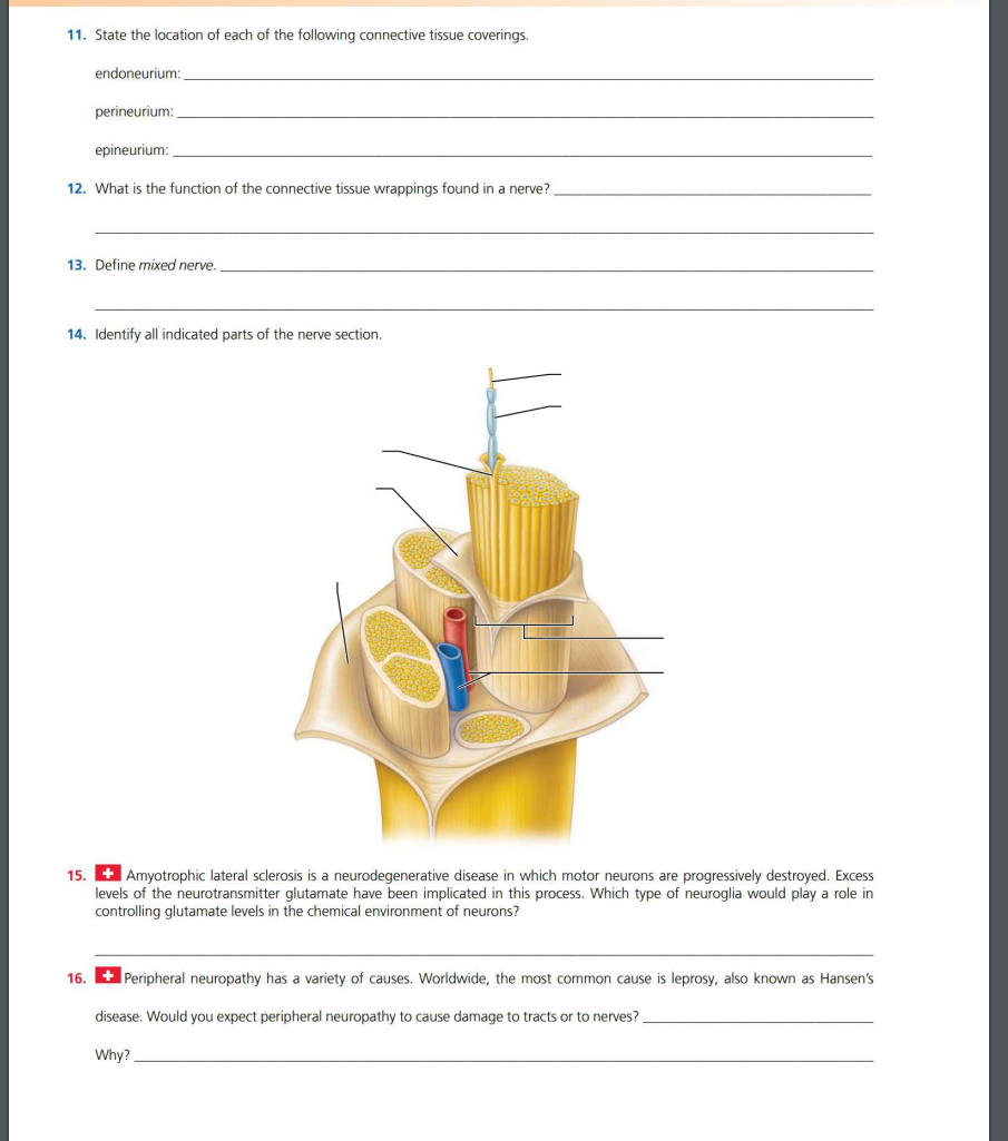 Solved 11. State the location of each of the following | Chegg.com
