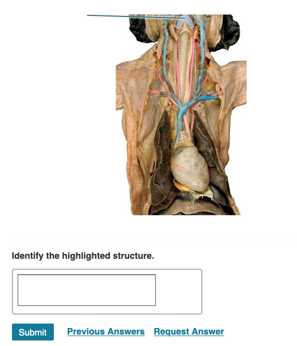 Solved Identify the highlighted structure. Submit Previous | Chegg.com