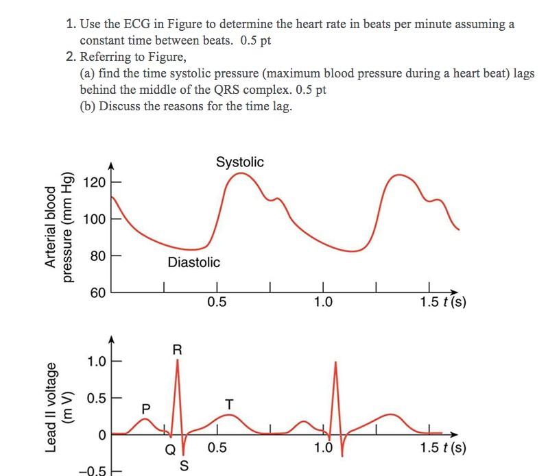 Solved 1. Use the ECG in Figure to determine the heart rate | Chegg.com