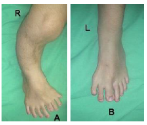 Solved An individual presents to the orthopedic clinic with | Chegg.com