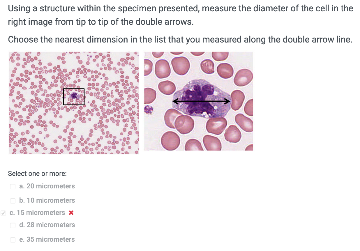 Solved Using a structure within the specimen presented, | Chegg.com