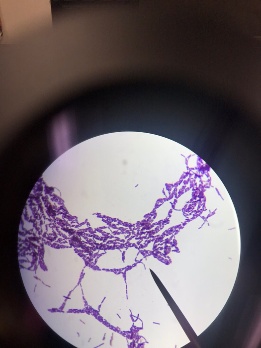 Solved What is this organism? Corynebacterium spp. , | Chegg.com