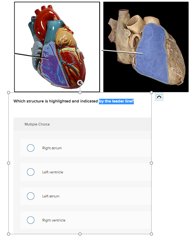 Solved Which structure is highlighted and indicated by the | Chegg.com