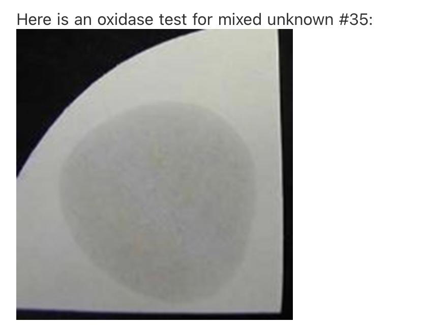 Solved Here is the gram stain for mixed unknown \#35: Here | Chegg.com