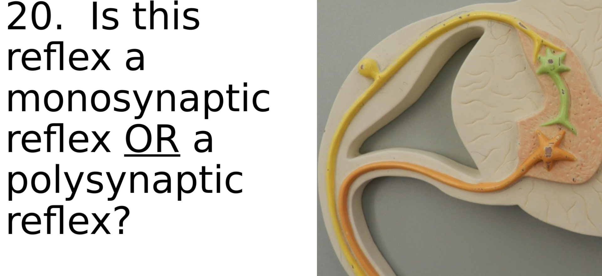 Solved 20. Is this reflex a monosynaptic reflex OR a | Chegg.com