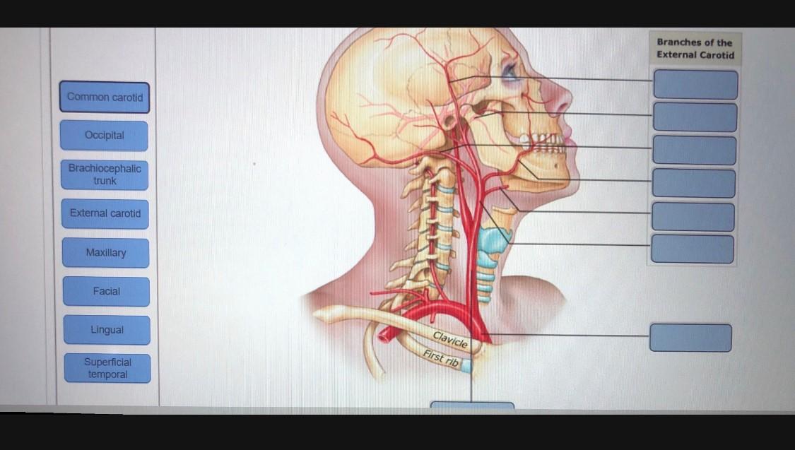 Solved Branches of the External Carotid Common carotid H | Chegg.com