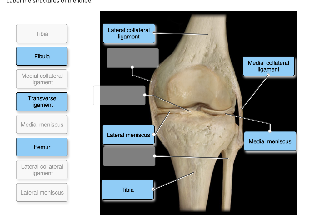 Solved Label the Structures of the Khee Lateral collateral | Chegg.com