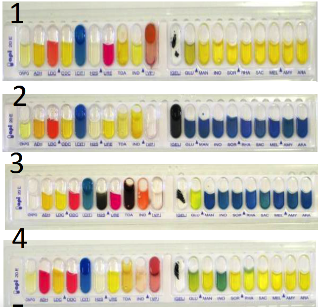 Solved Using the API 20 E diagnostic tool, identify all | Chegg.com