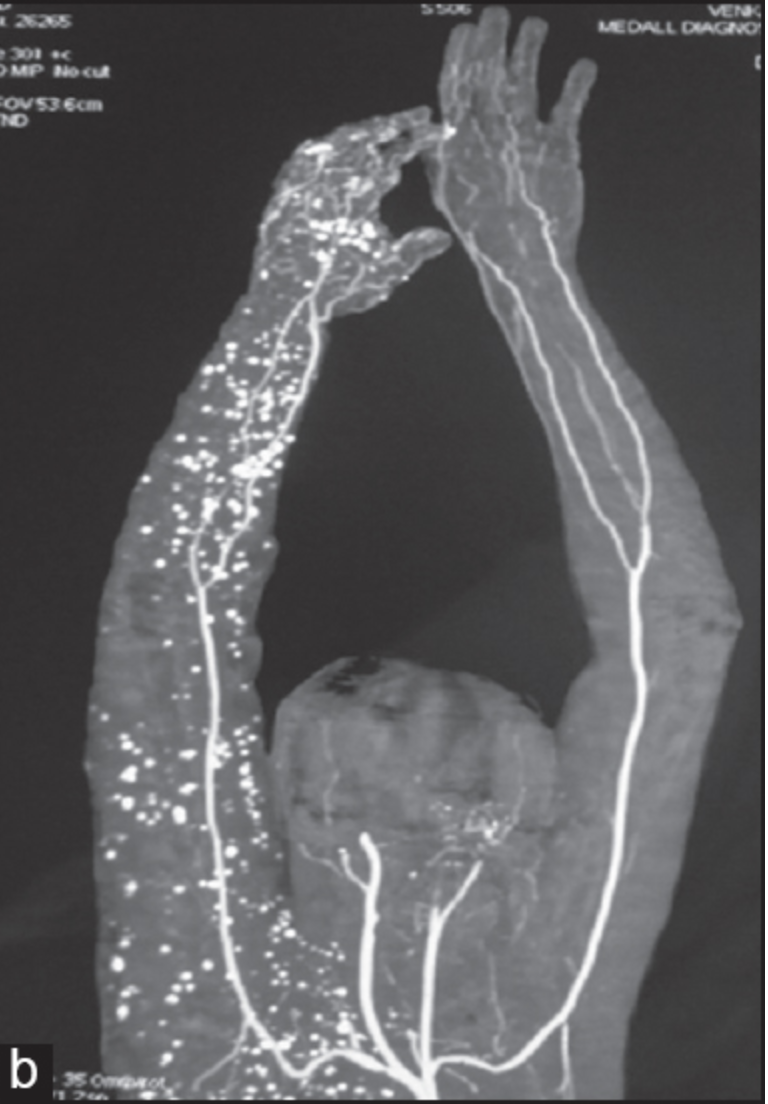 Label all of the veins and arteries you can see on | Chegg.com